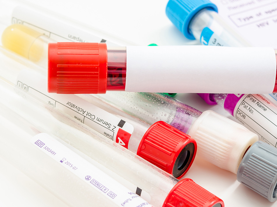 Human myeloperoxidase/MPO ELISA Kit检测试剂盒（酶联免疫吸附法） - 联科生物